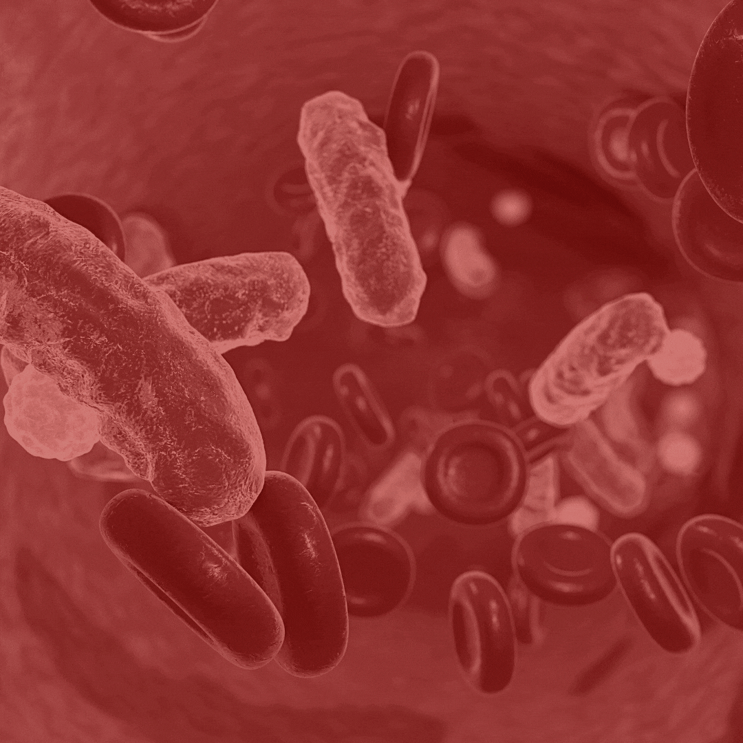 Sepsis2021 | Campus de RedEMC.net