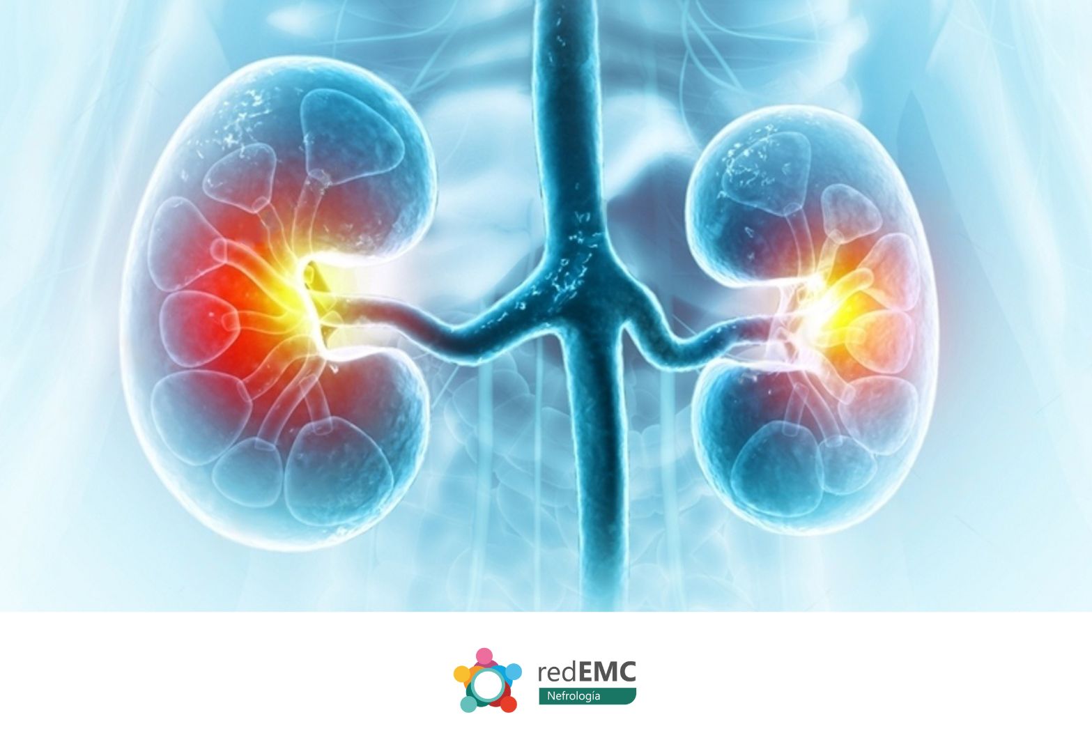 Nefropatía Diabética 2024: Atención integral de personas con diabetes ...